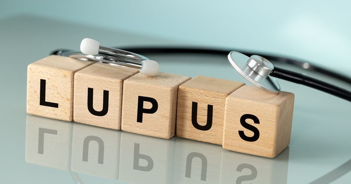 What Lupus Looks Like for Most People - Facty Health
