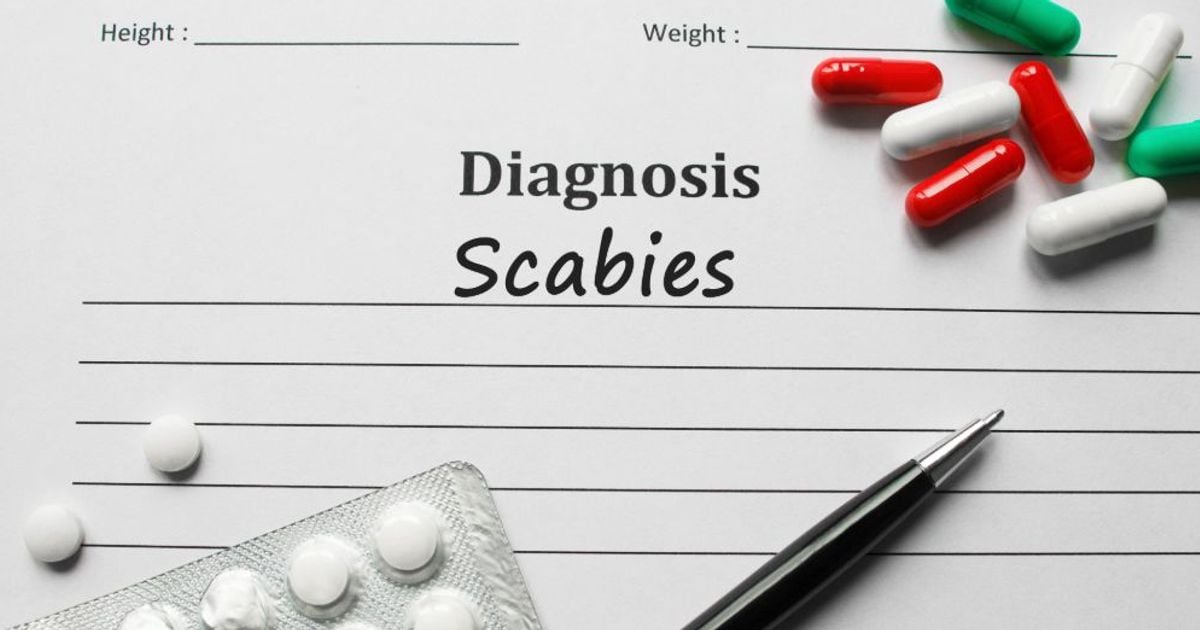 Recognizing the Signs of Scabies - Facty Health