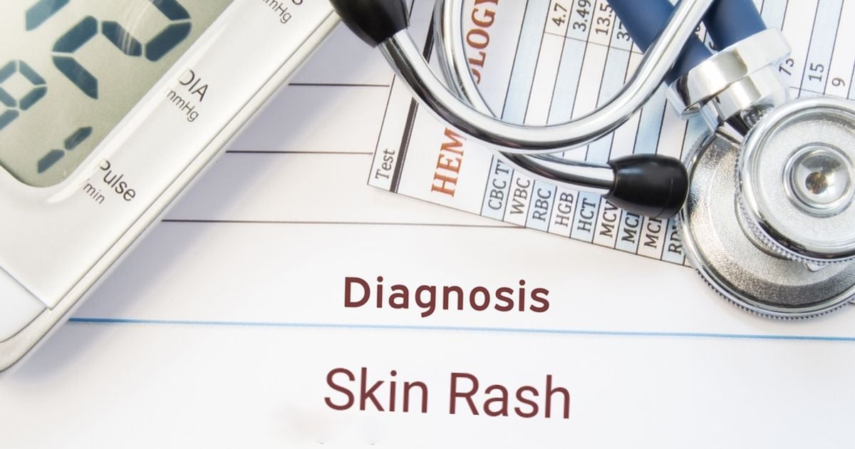 Skin Rashes and Their 12 Potential Causes - Facty Health