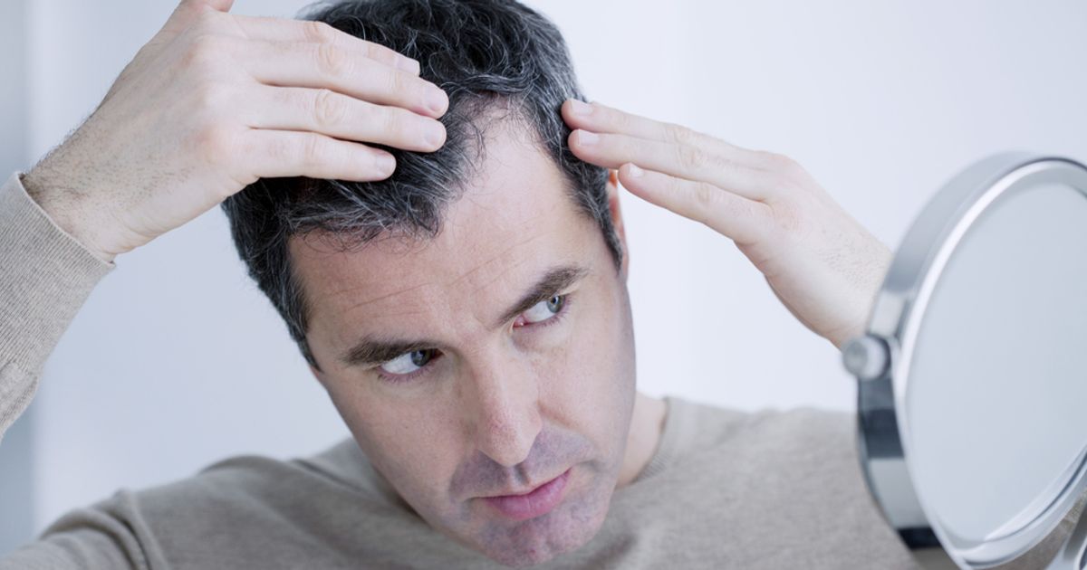 Top Causes of Hair Loss in Men - Facty Health
