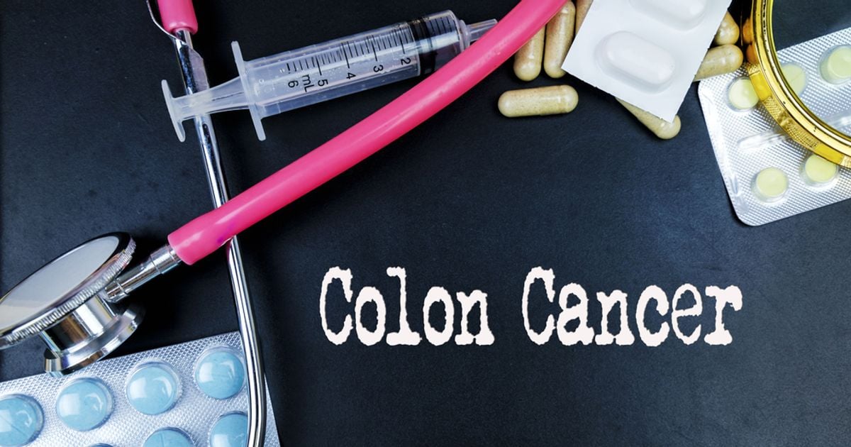 Colon Cancer Symptoms and Stages - Facty Health