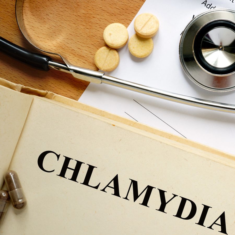 Mild Chlamydia Symptoms In Men