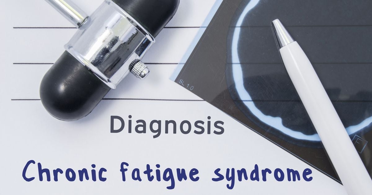 Understand Chronic Fatigue Syndrome - Facty Health