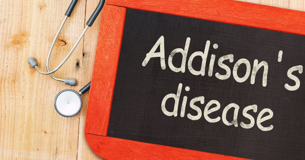 10 Symptoms of Addison's Disease - Facty Health