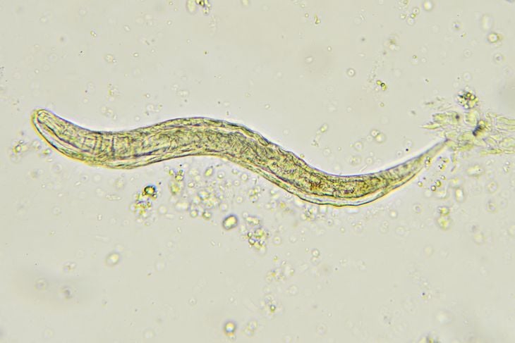 Effective Home Remedies for Pinworms: A Comprehensive Guide - Facty Health