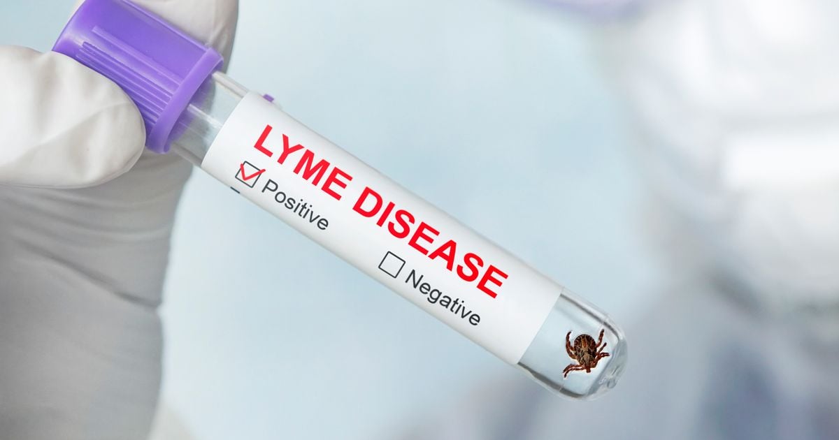 Diagnosis and Treatments for Lyme Disease - Facty Health