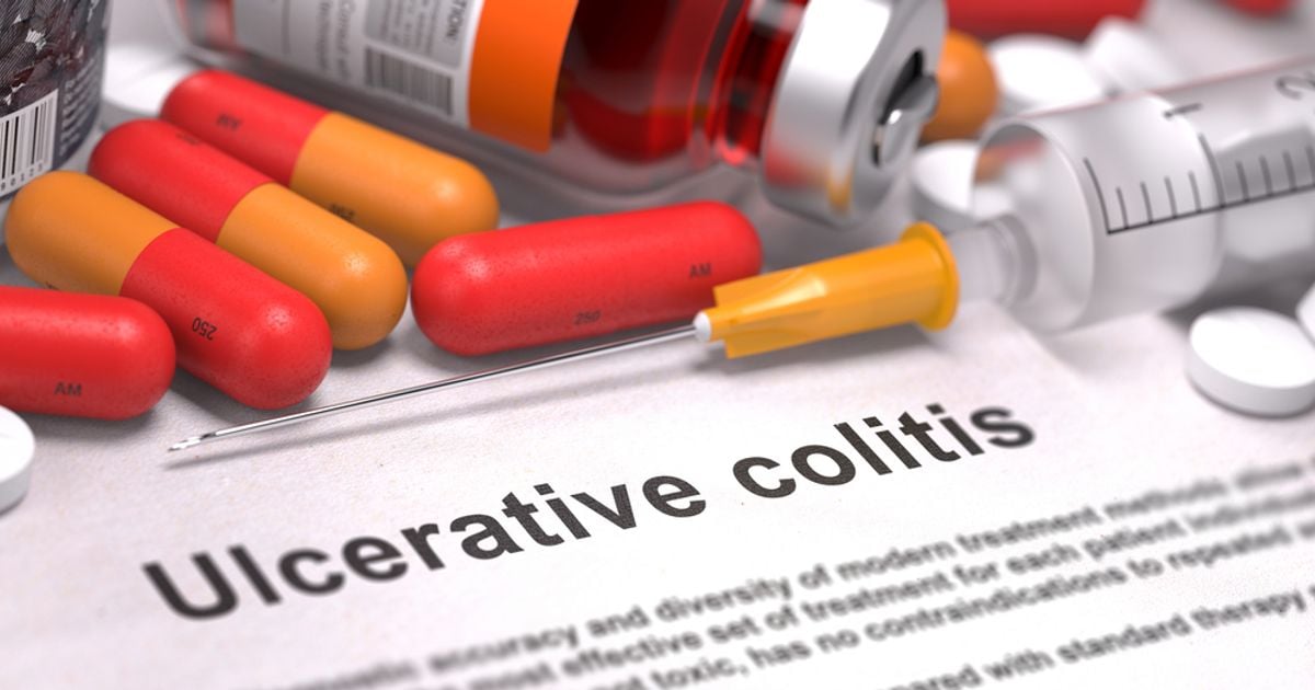 10 Treatments of Ulcerative Colitis - Facty Health