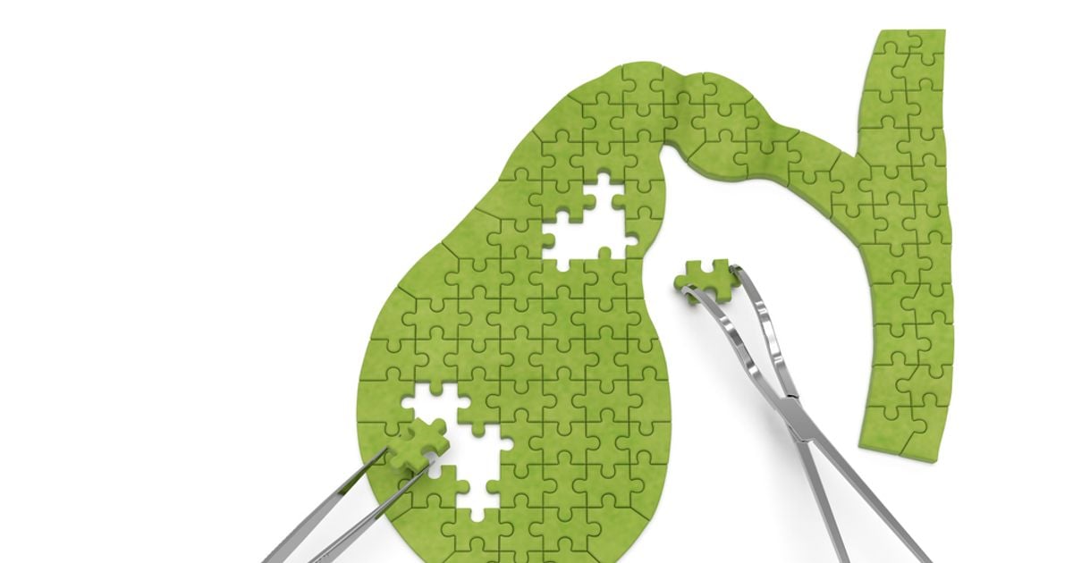 10 Tips for a Healthy Gallbladder - Facty Health