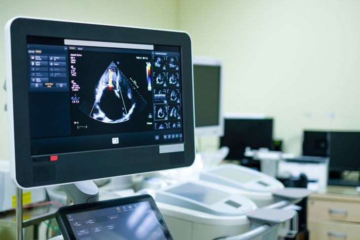 10 Key Facts to Know About Echocardiograms - Facty Health