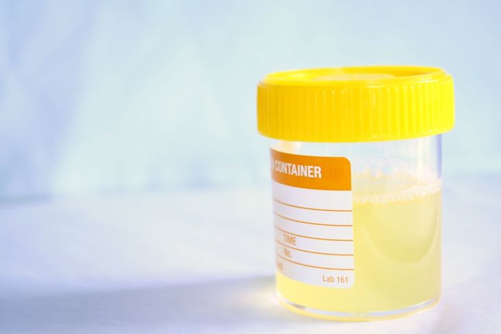 Causes, Symptoms, and Treatments of Cloudy Urine - Facty Health