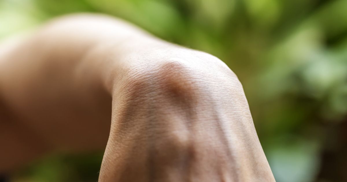FAQ s About Lumps Facty Health