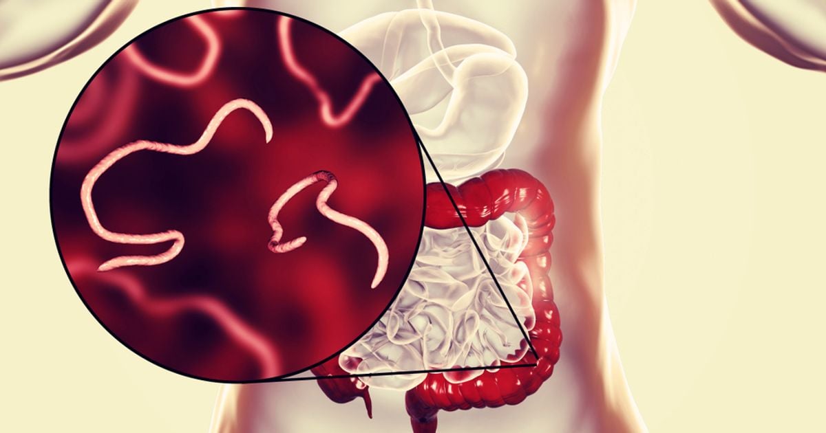 Recognizing The Indicators Of Human Body Worms Facty Health