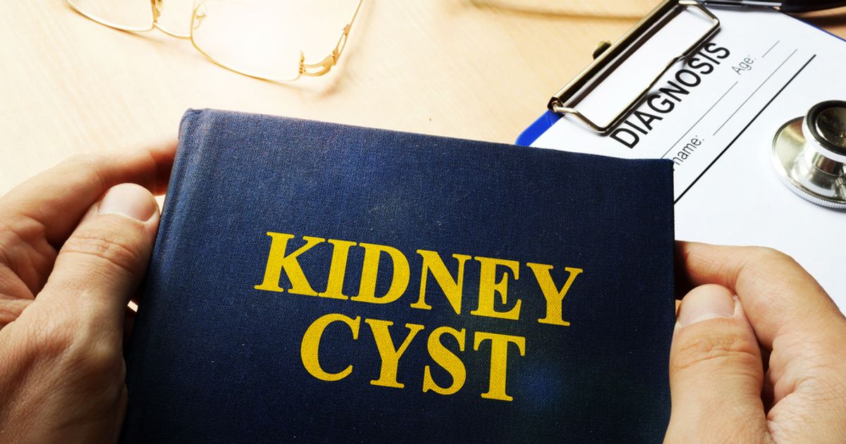 10 Symptoms of Kidney Cysts - Facty Health