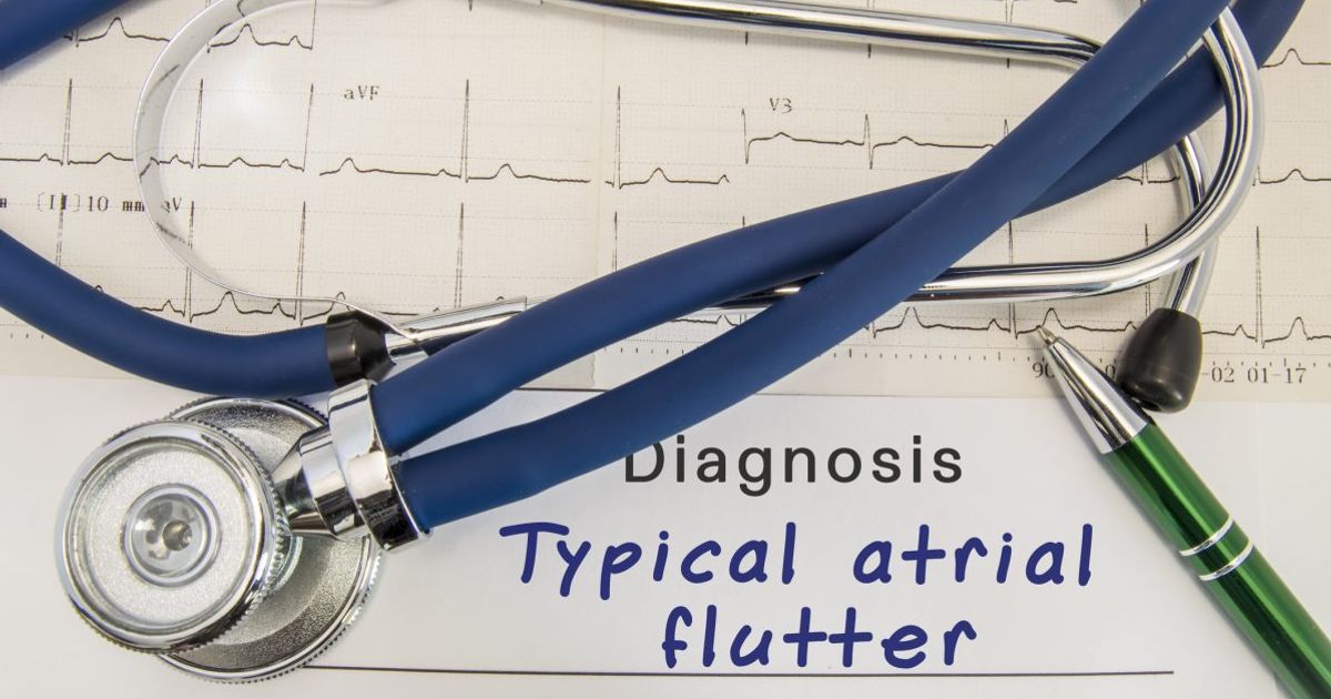 Frequently Asked Questions About Atrial Flutter - Facty Health
