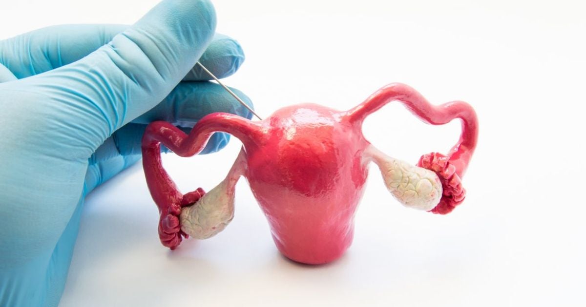 Frequently Asked Questions About Myomectomy Surgery - Facty Health