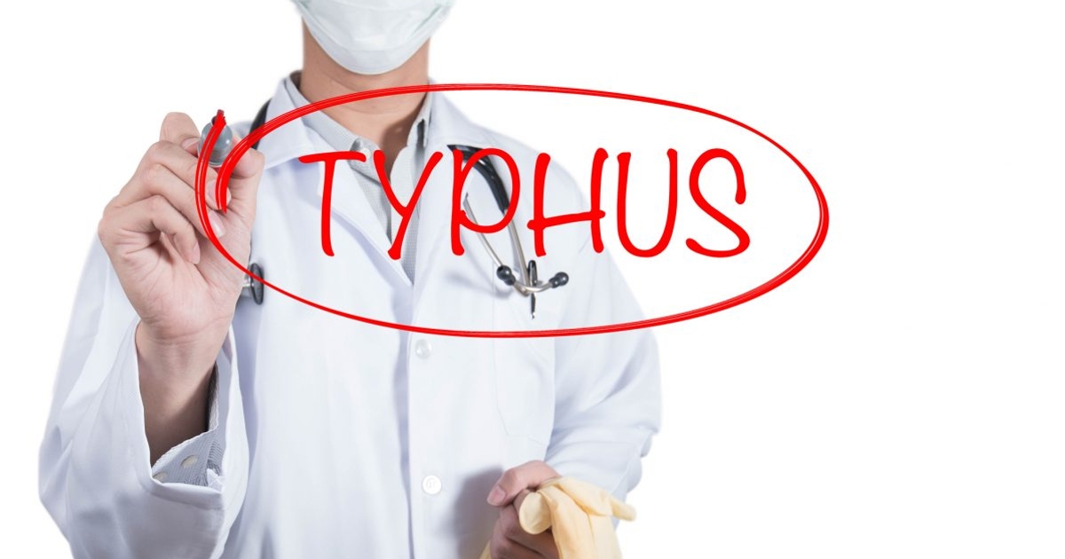 Causes, Symptoms, and Treatments of Typhus - Facty Health