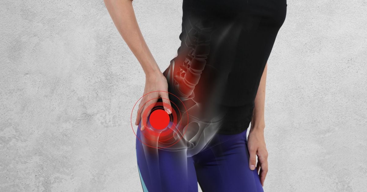 What is Greater Trochanteric Pain Syndrome? - Facty Health