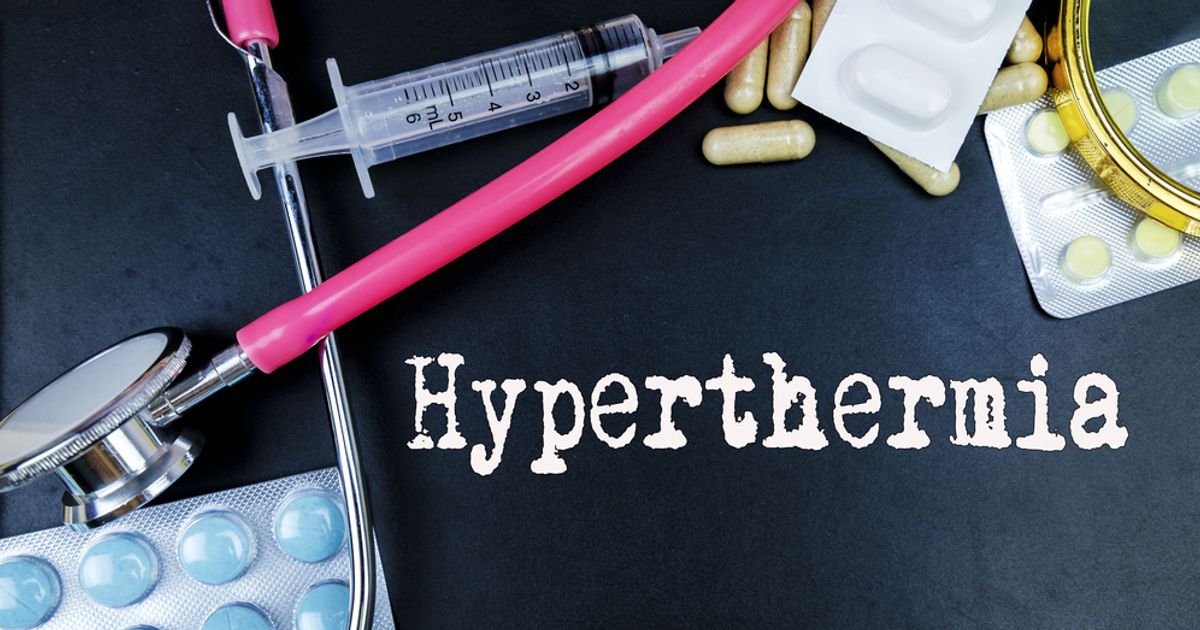 10 Causes, Symptoms, and Treatments of Hyperthermia - Facty Health