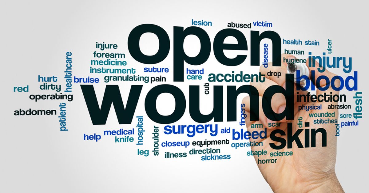 Frequently Asked Questions About Wound Infections - Facty Health