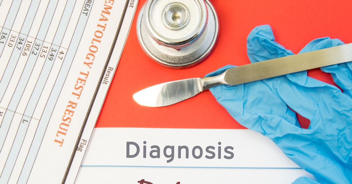 10 Facts About Polyps - Facty Health