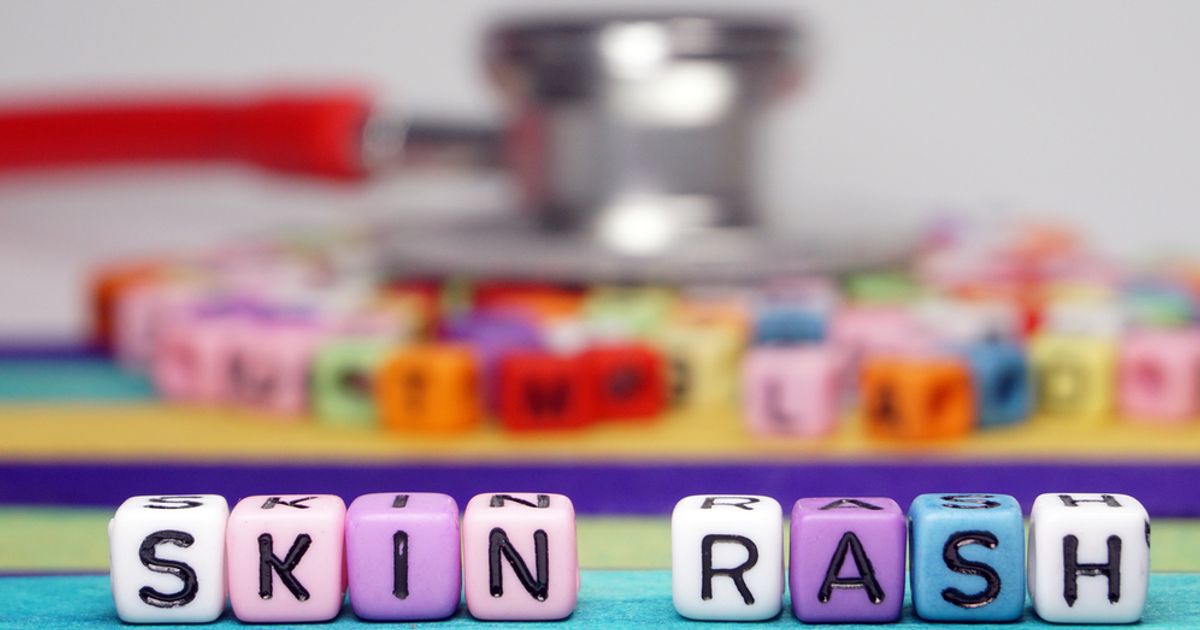 What is a Viral Rash? - Facty Health