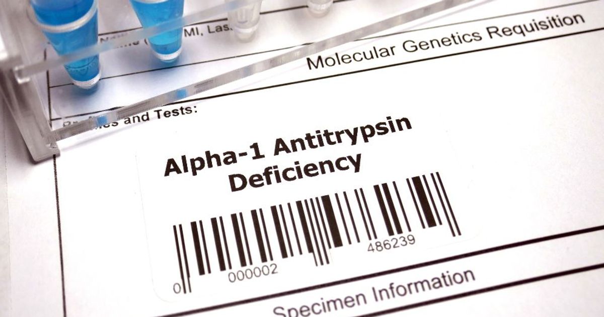 Effects of Alpha-1 Antitrypsin Deficiency (A1AD) - Facty Health
