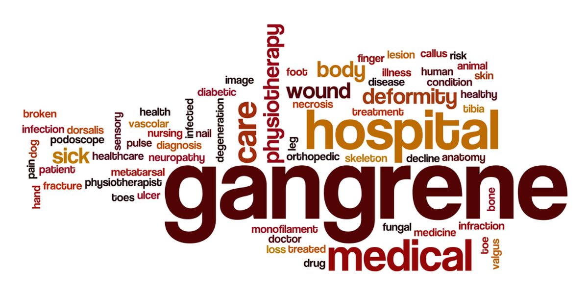Types of Gangrene - Facty Health