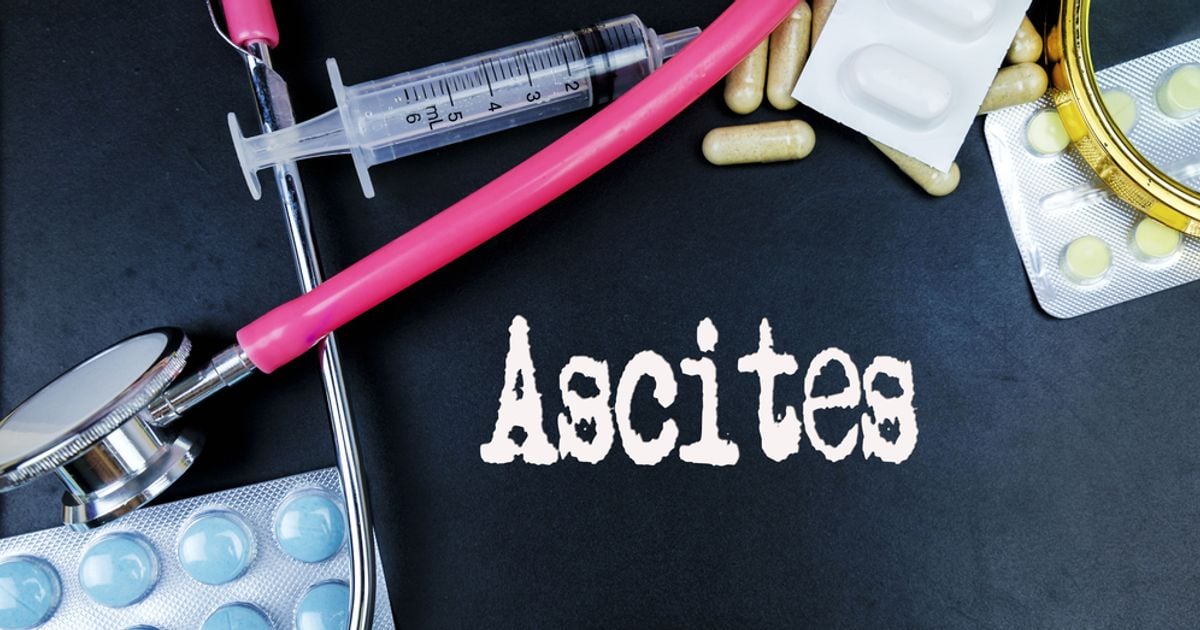 Understanding Ascites: Causes, Symptoms, and Treatments - Facty Health