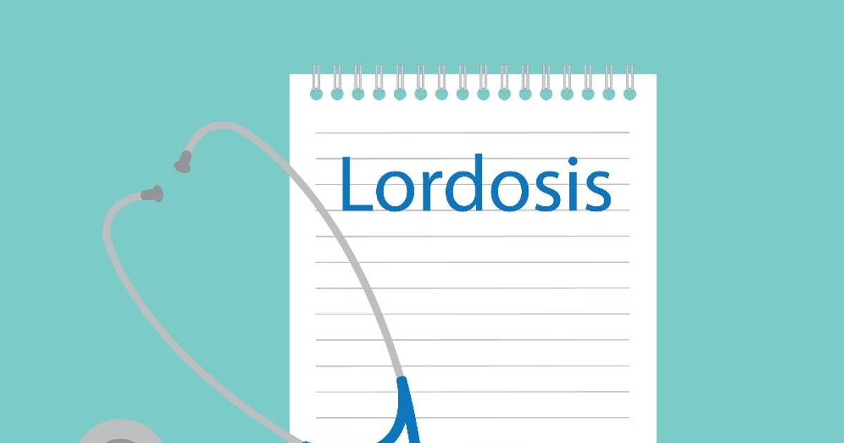 What is Lordosis? - Facty Health