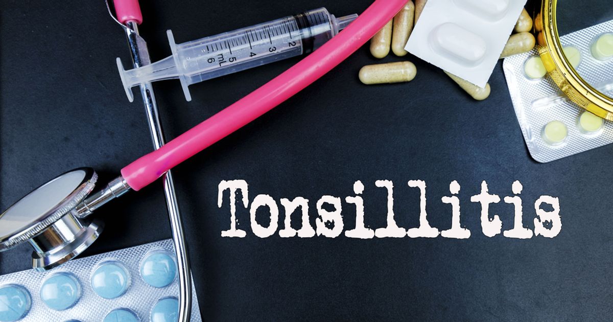 Is Tonsillitis Contagious? - Facty Health
