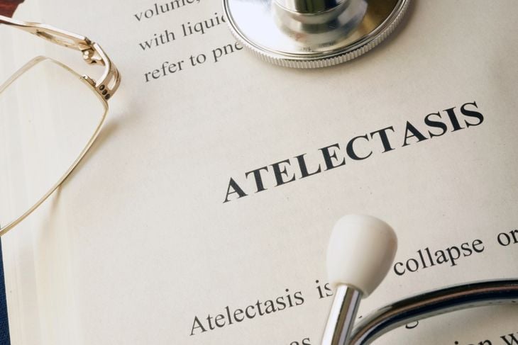 Comprehensive Guide to Understanding Atelectasis - Facty Health