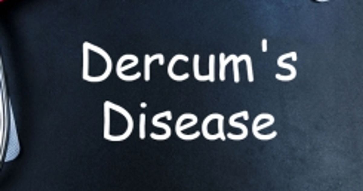 What is Dercum's Disease? - Facty Health