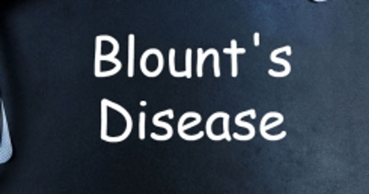 Causes and Treatments of Blount's Disease - Facty Health