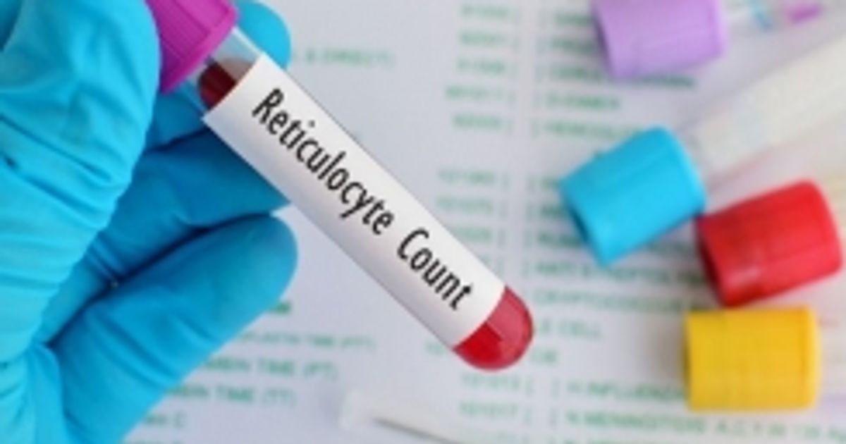 What are Reticulocytes? - Facty Health