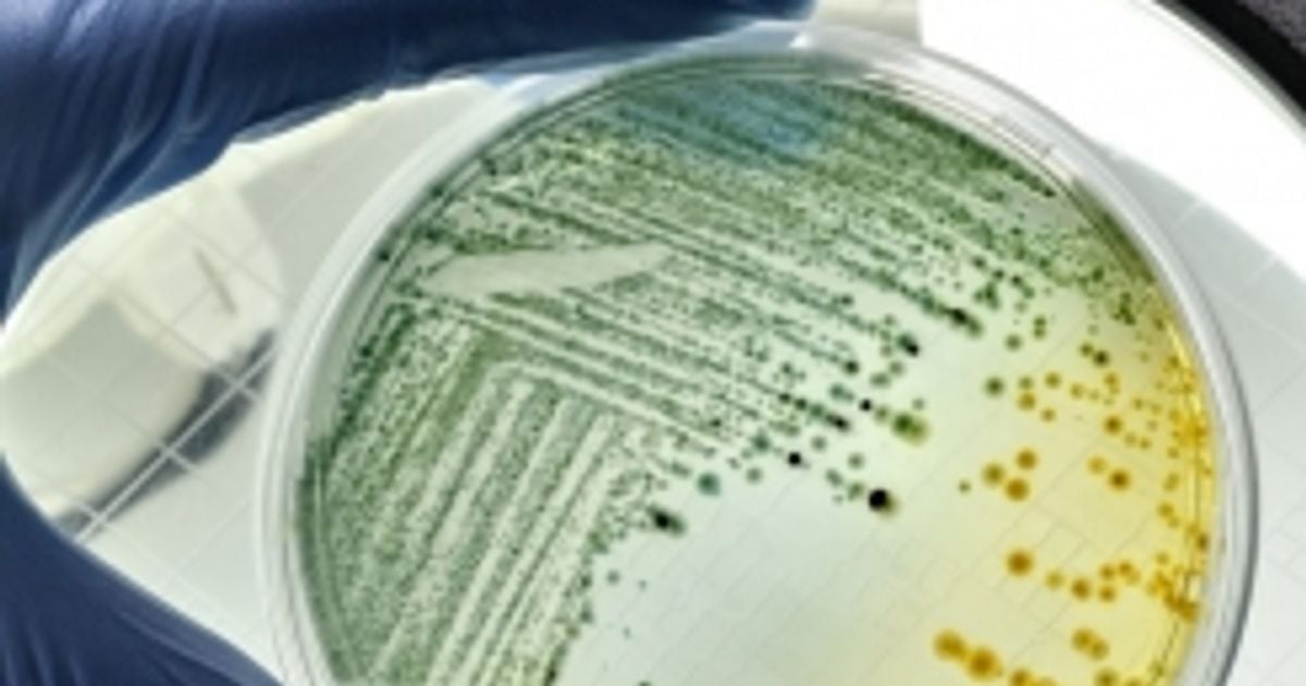 E. coli Causes and Treatments - Facty Health