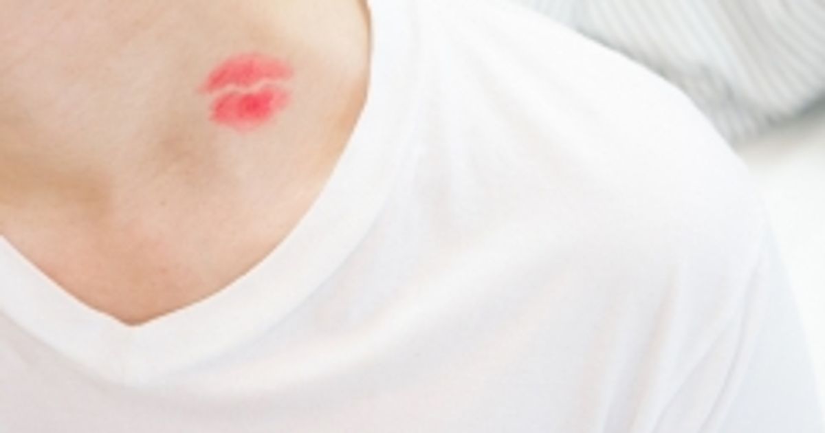 How to Get Rid of a Hickey - Facty