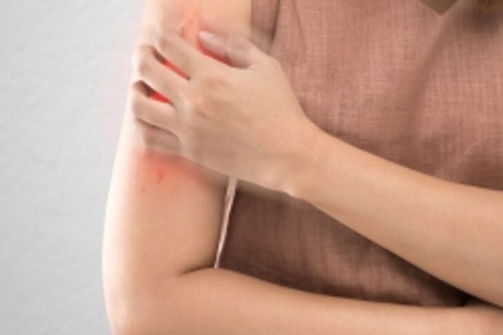 The Types of Dermatitis - Facty Health