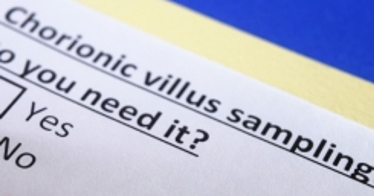 Chorionic Villus Sampling: Purpose, Risks, and Expectations - Facty Health