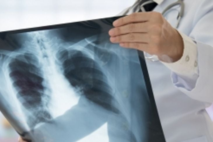 What is a Bullectomy? - Facty Health