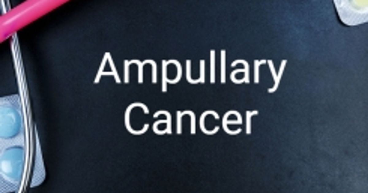 Facts About Ampullary Cancer - Facty Health