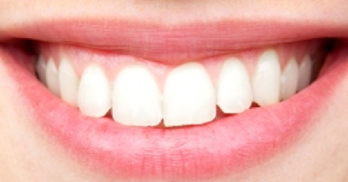 Receding Gums: Causes, Treatments, and Tips for Prevention - Facty Health
