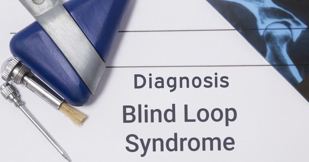 What is Blind Loop Syndrome? - Facty Health