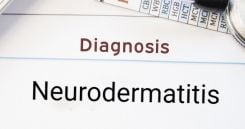 What is Neurodermatitis? - Facty Health