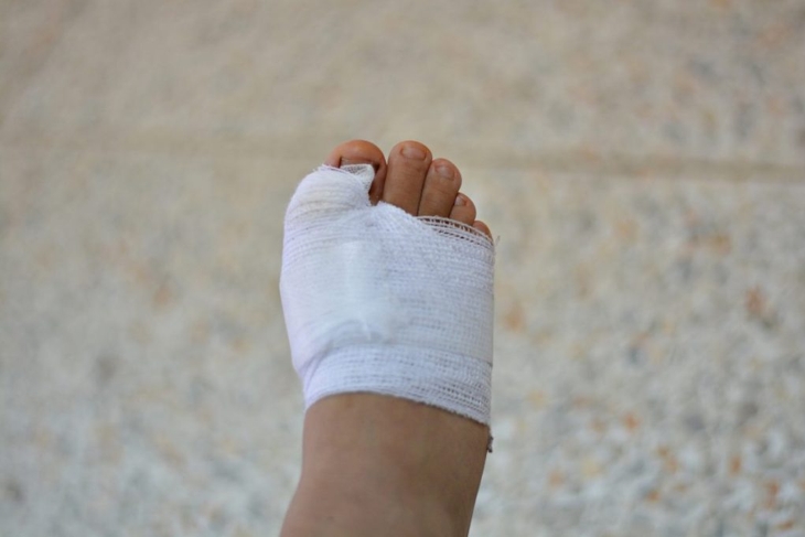 Causes, Symptoms and Treatment of Calciphylaxis - Facty Health