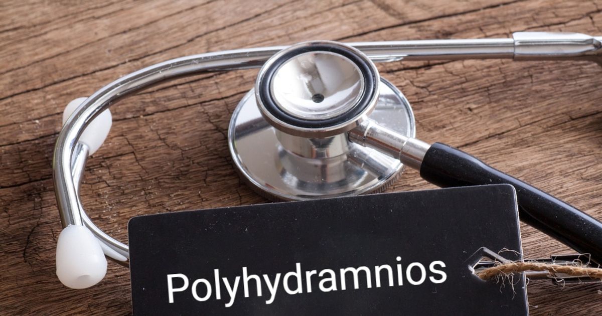 Polyhydramnios: Excessive Accumulation of Amniotic Fluid - Facty Health
