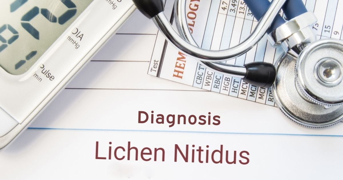 What is Lichen Nitidus? - Facty Health