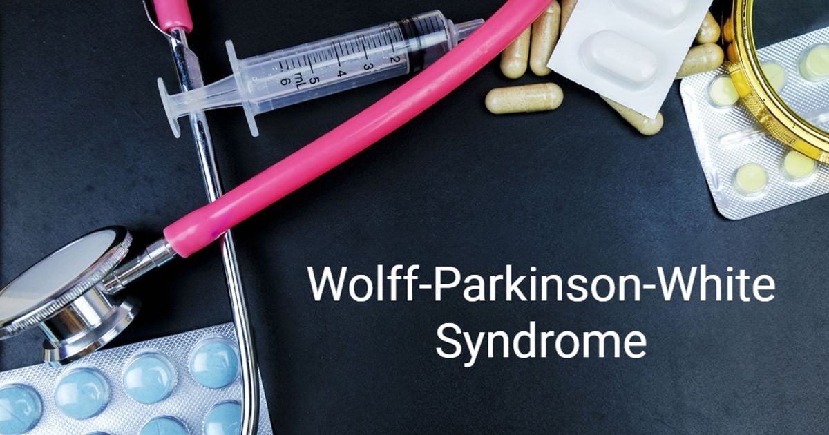Understanding Wolff-Parkinson-White Syndrome - Facty Health