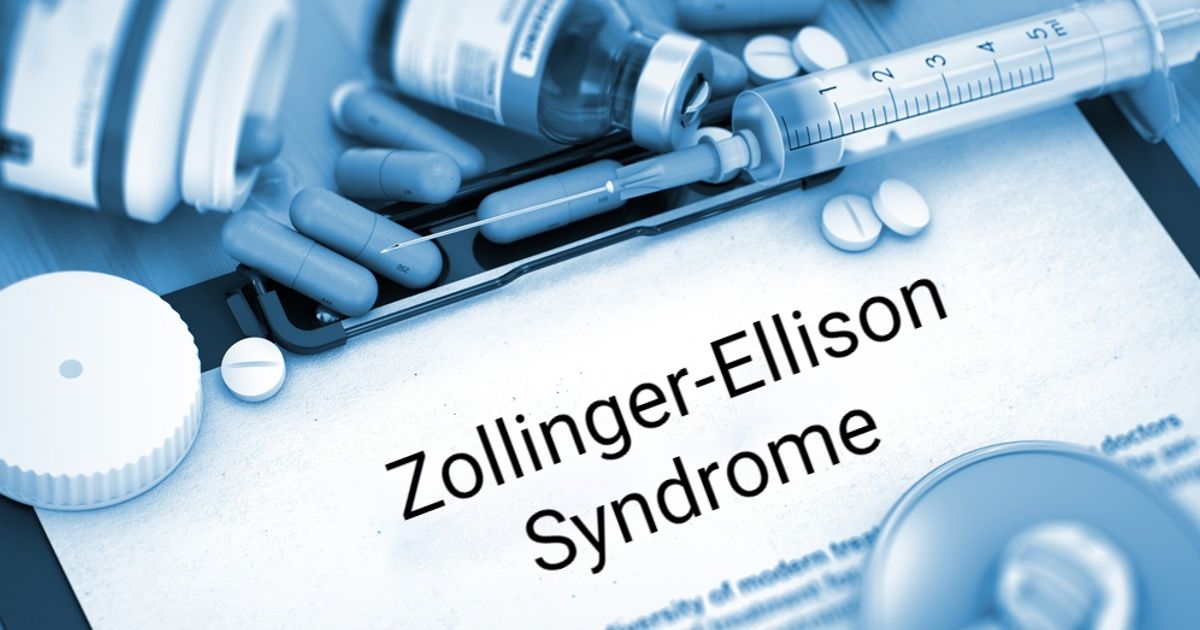 Pancreatic Tumors: Zollinger-Ellison Syndrome - Facty Health