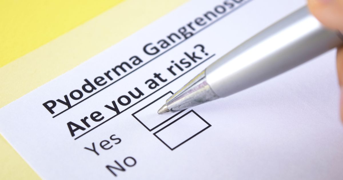 Pyoderma Gangrenosum Is an Inflammatory Skin Condition - Facty Health