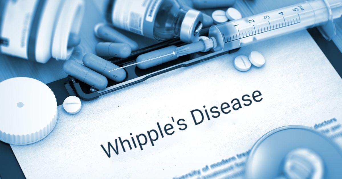A Bacterial Infection Leads to Whipple's Disease - Facty Health